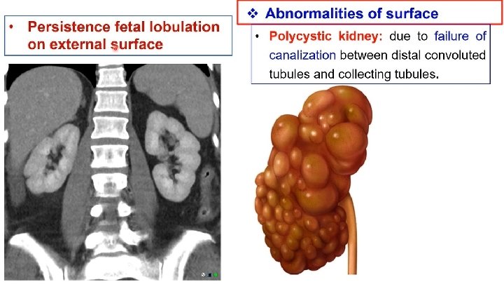 Development of kidney ureter The kidneys developed from