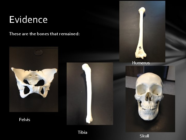 Bone Detectives Vaidehi Gajjar Brooke Moen Ashli Brown