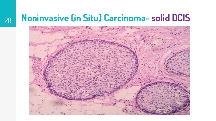 Female Genital System Breast Pathology Ghadeer Hayel MD