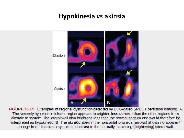Basics of Cardiac Nuclear Imaging v Dr Amol