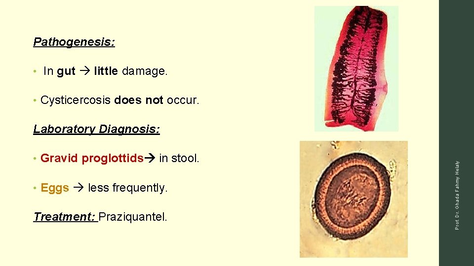 Prof Dr Ghada Fahmy Helaly Introduction to Cestodes