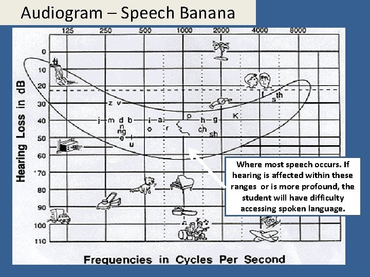 Hearing Loss Adapted from NYDBC Susie Morgan Types