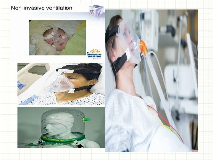 NONINVASIVE VENTILATION Lijun Ding 23 Jan 2018 Learning