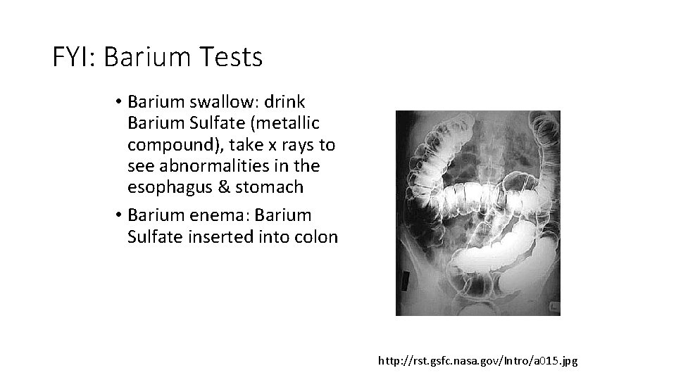 Large Intestine Colon Eliminates undigestedunabsorbed wastes Absorbs water