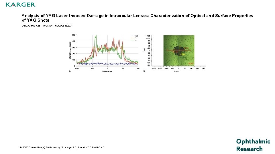 Analysis of YAG LaserInduced Damage in Intraocular Lenses