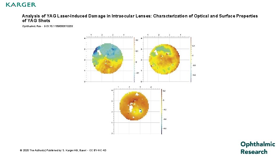 Analysis of YAG LaserInduced Damage in Intraocular Lenses