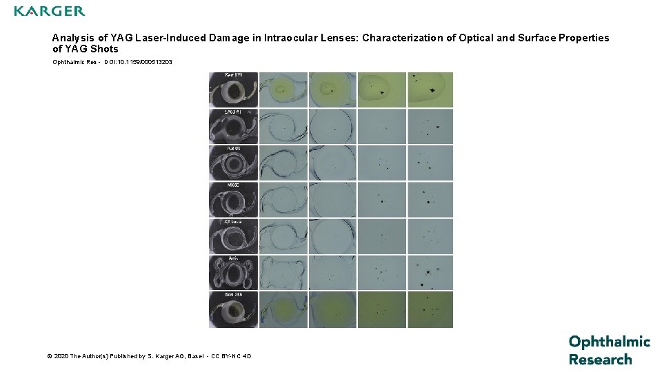 Analysis of YAG LaserInduced Damage in Intraocular Lenses