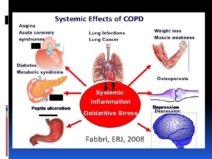 COPD AS Systemic disease BY DrSami ELDahdouh MD