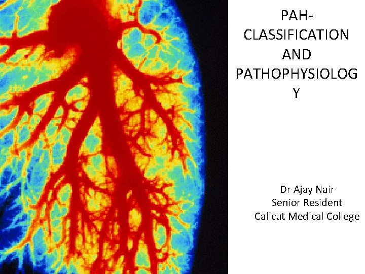 PAHCLASSIFICATION AND PATHOPHYSIOLOG Y Dr Ajay Nair Senior