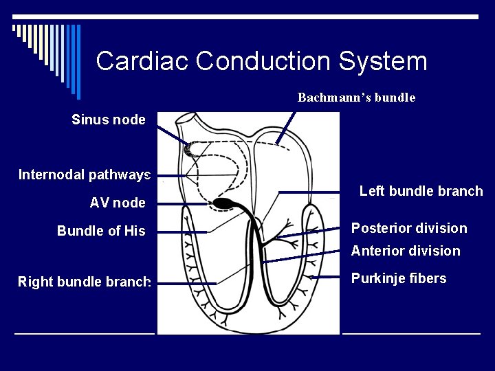 Diagnosis of Myocardial InfarctionIschemia with Bundle Branch Blocks