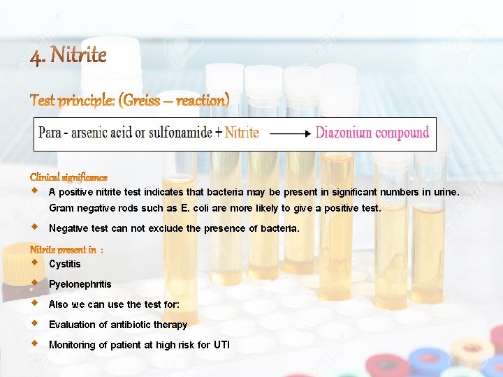 Urinalysis Chemical examination of urine Routine chemical examination