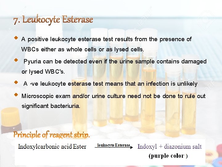 Urinalysis Chemical examination of urine Routine chemical examination
