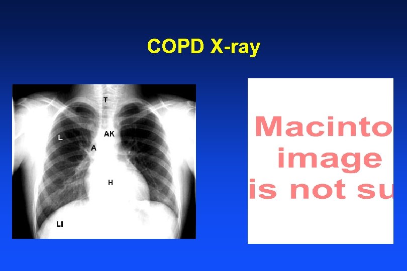 Respiratory Diseases Pathophysiology and Medical Treatments Respiratory ...
