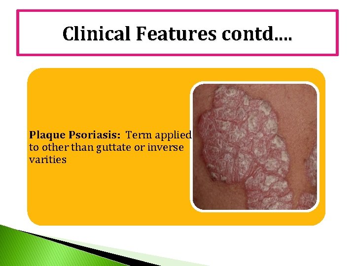 PSORIASIS Mandala Pundareeka Ek Kushtha Roga By Dr