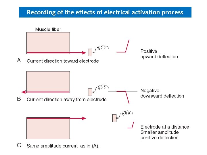 Practical Electrocardiography Atrial Enlargment Ventricular Hypertrophy ...