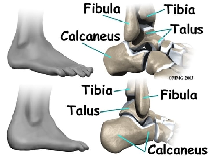 Ankle Bones and Joints The ankle joint is
