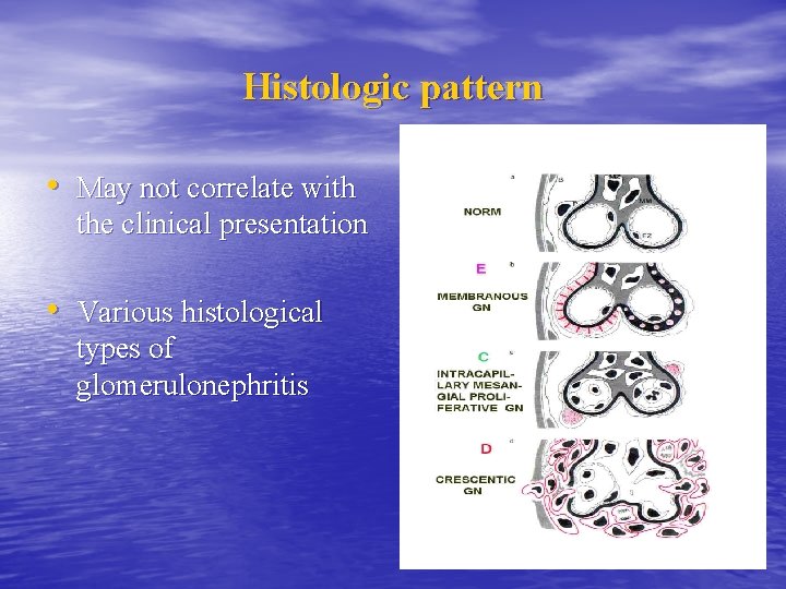 Glomerular Diseases Anatomy of the glomerulus and the