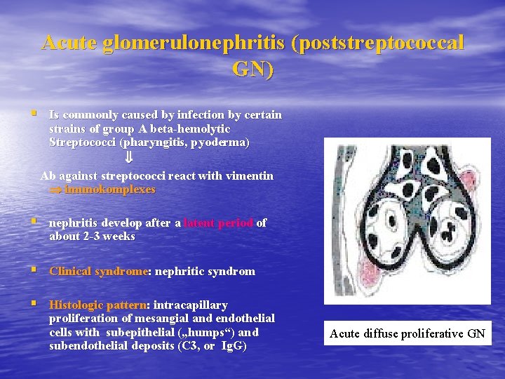 Glomerular Diseases Anatomy of the glomerulus and the
