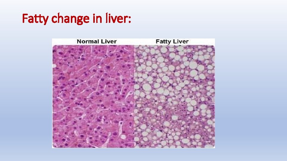Cell injury and accumulation 2 By Basma Tito