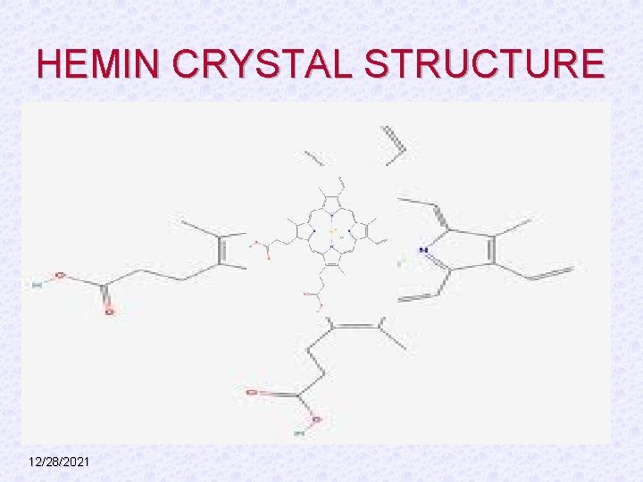 Learning Objectives Fetal Hb Carboxy Hb MetHb Hemoglobinopathies