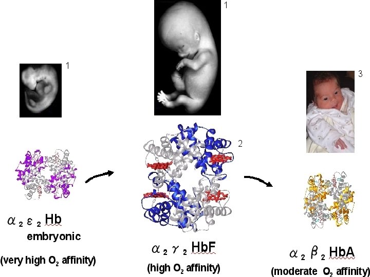 Learning Objectives Fetal Hb Carboxy Hb MetHb Hemoglobinopathies