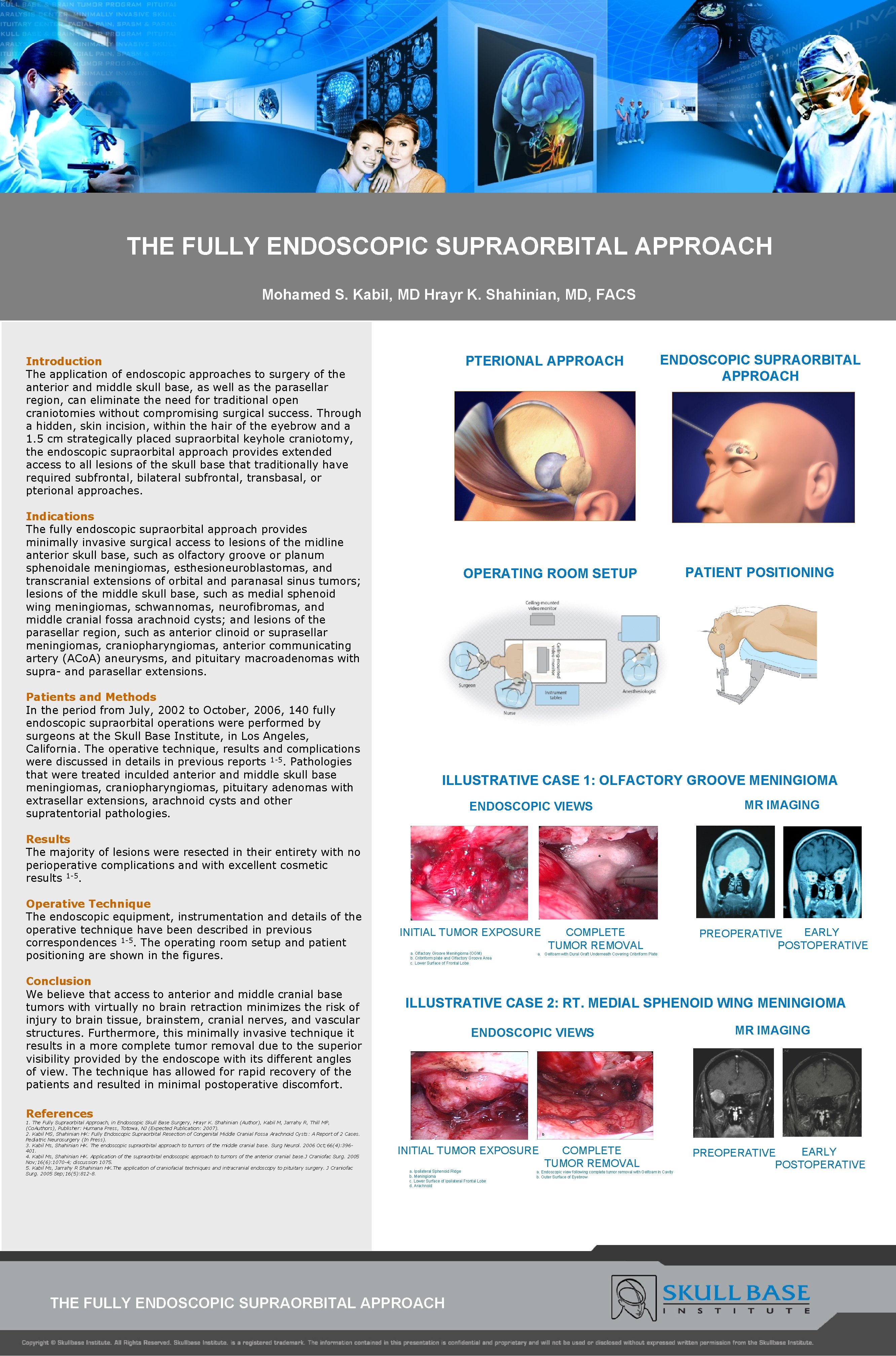 THE FULLY ENDOSCOPIC SUPRAORBITAL APPROACH Mohamed S Kabil