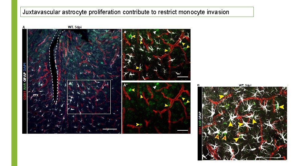 INTRODUCTION SCIENTIFIC QUESTIONS How does astrocyte proliferation affect