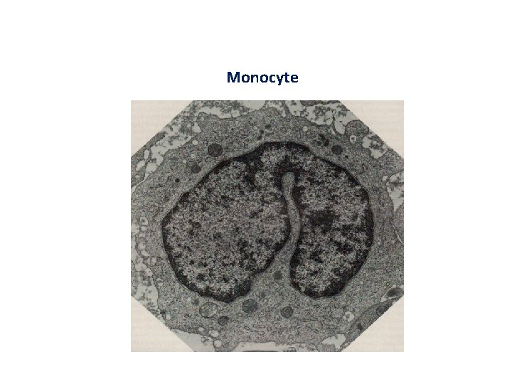 Blood is a tissue composed of Erythrocytes the