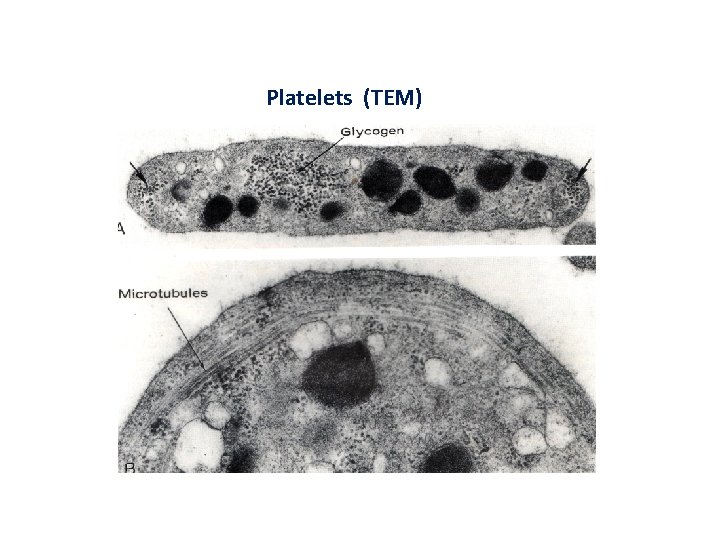 Blood is a tissue composed of Erythrocytes the