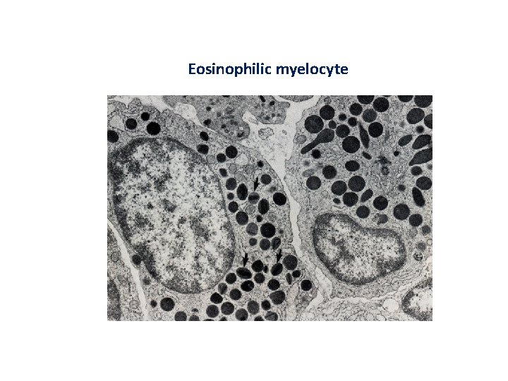 Blood is a tissue composed of Erythrocytes the