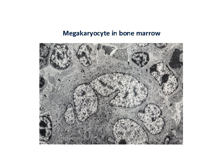 Blood is a tissue composed of Erythrocytes the
