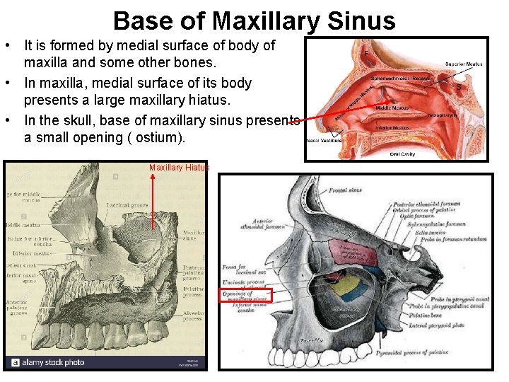PARANASAL AIR SINUSES Presented by Dr Sushma Tomar