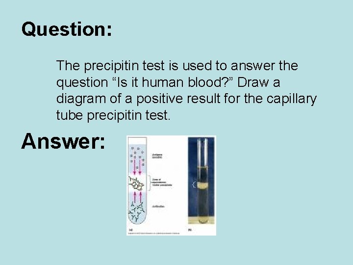 Serology Unit Review Question What blood type does