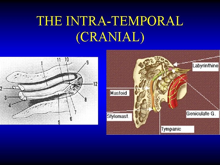 THE FACIAL NERVE FACIAL NERVE FIBERS Motor to