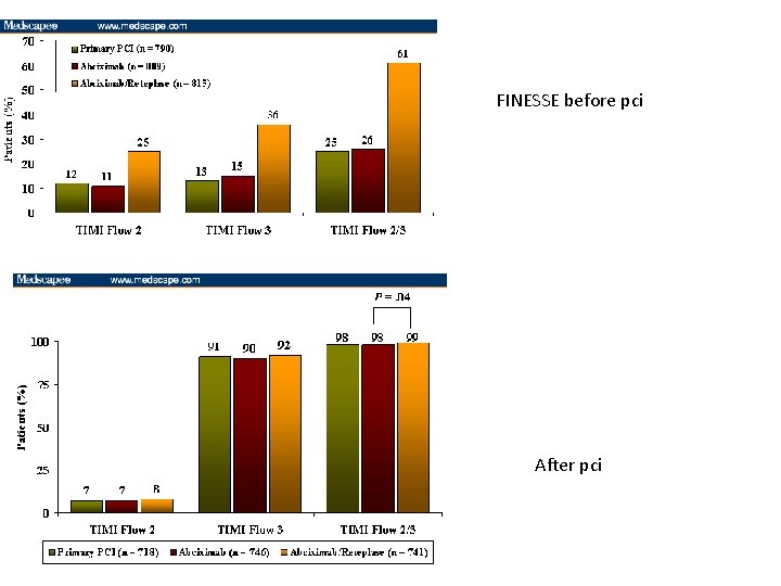 Facilitated PCI rescue PCI Dolly mathew Primary PCI