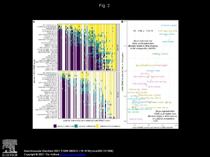 Miyoshi myopathy and limb girdle muscular dystrophy R