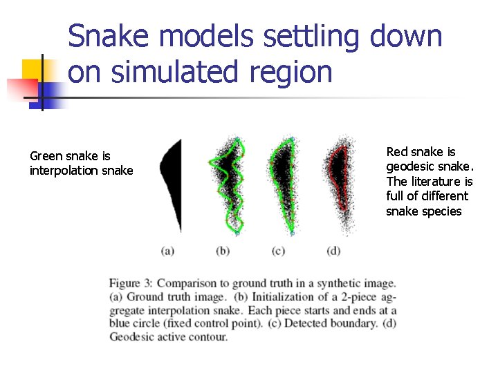 Interpolation Snakes Work by Silviu Minut Ultrasound image