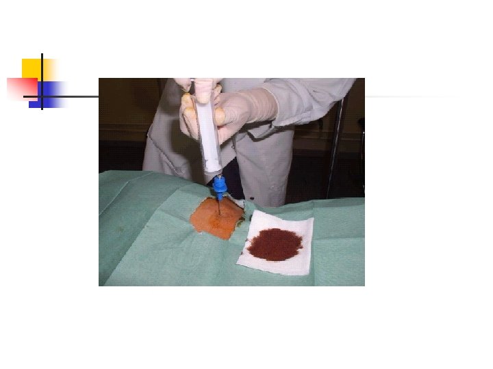 Hmogramme Mylogramme DCEM 3 TD N 3 24