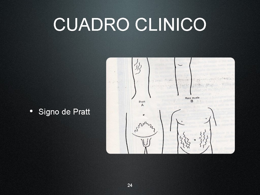 TROMBOSIS VENOSA PROFUNDA Dr Guillermo Guevara Ospino Servicio