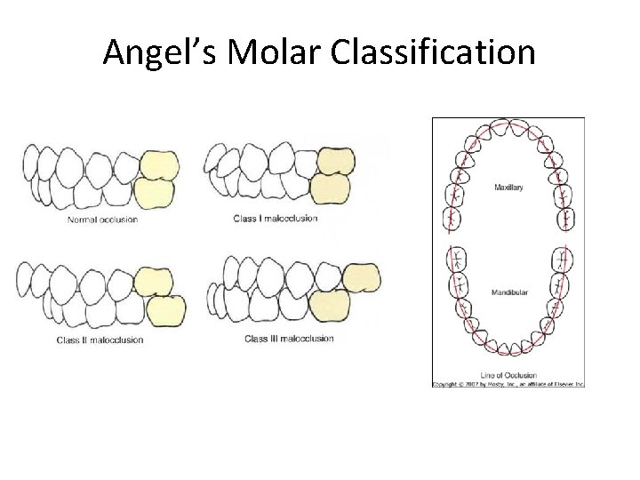 The Nature of Orthodontic Problems and Malocclusion Evolution