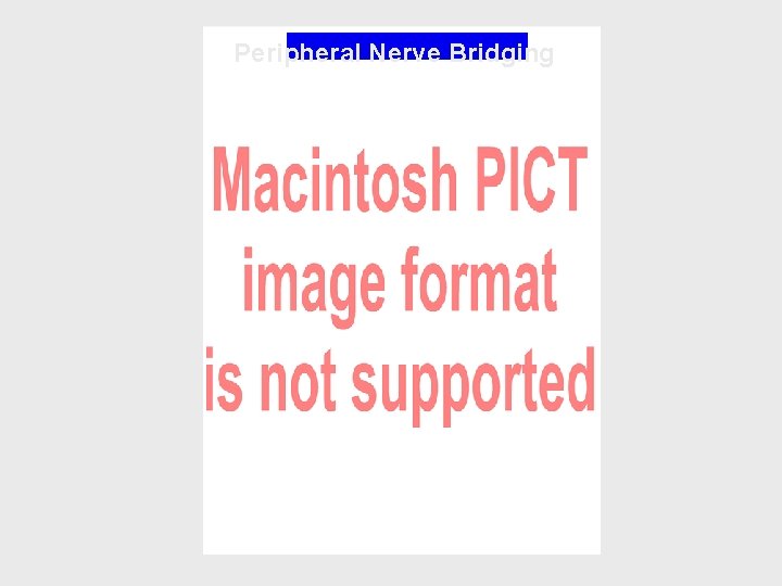 Bases for Hope for Spinal Cord Injury Wise