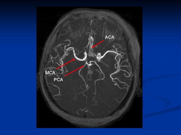 1 Frontal bone 2 Parietal bone 3 Dura