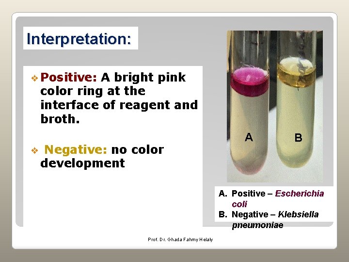 Biochemical Reactions General Microbiology Lab 5 By Prof