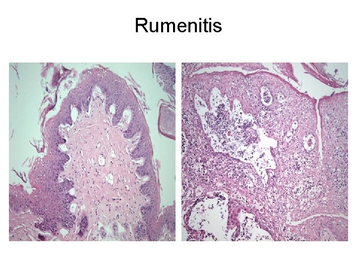 Ruminant Forestomach Normal Anatomy Rumen papillae Reticulum epithelial