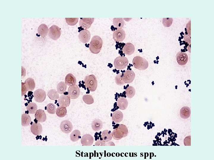 Genul Staphylococcus Genus Staphylococcus Caractere generale Fam ...