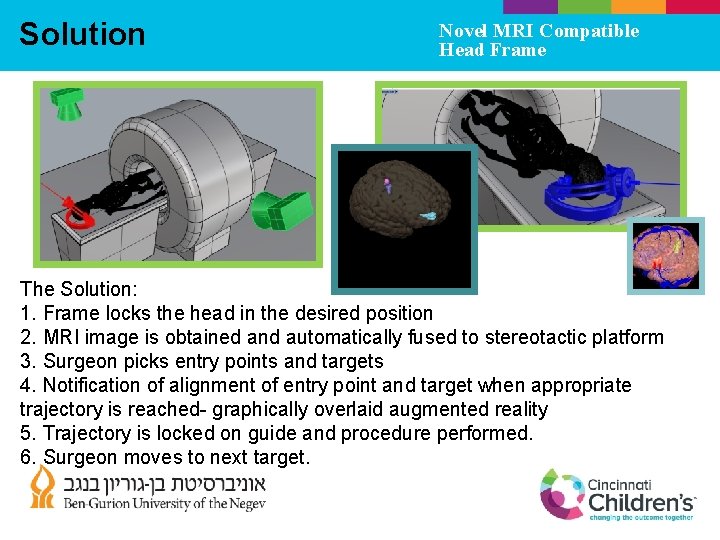 NOVEL HEAD FRAME FOR WHOLE BRAIN MRI REALTIME
