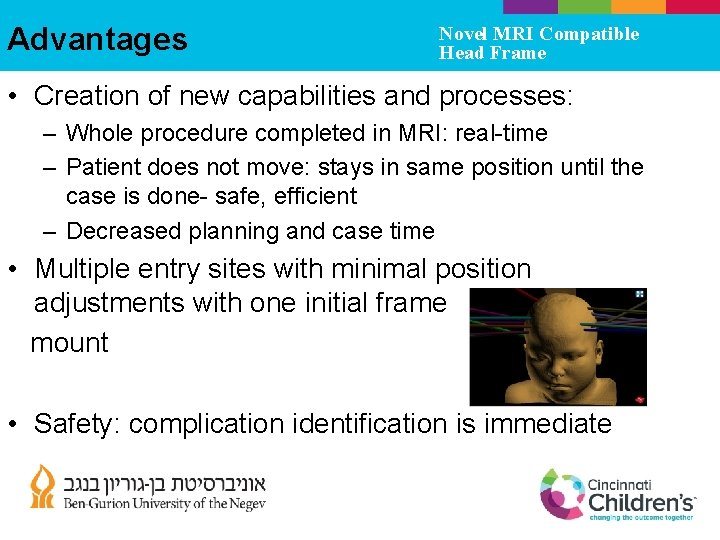 NOVEL HEAD FRAME FOR WHOLE BRAIN MRI REALTIME