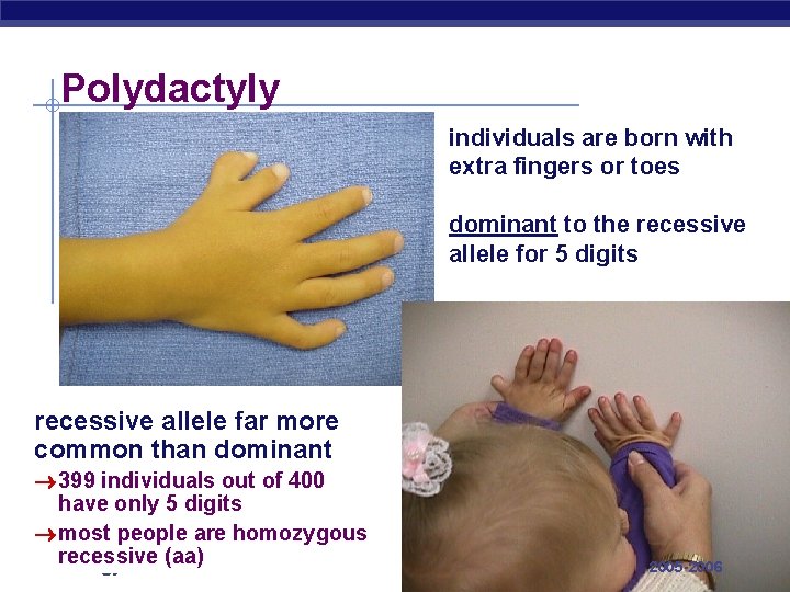 Chapter 14 Beyond Mendels Laws of Inheritance AP