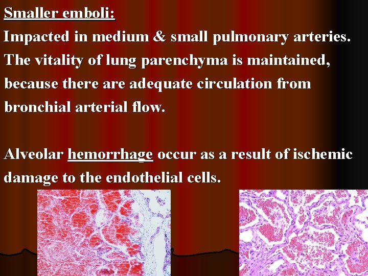 Respiratory system Lecture 1 Atelectasis and Disturbances of