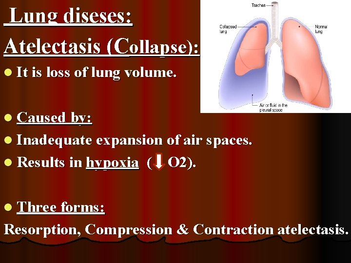 Respiratory system Lecture 1 Atelectasis and Disturbances of